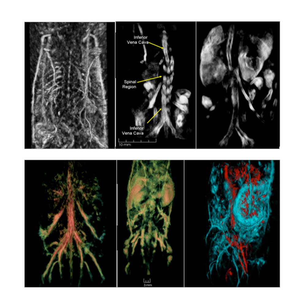 Advanced Photoacoustic Imaging and Tomography Solutions