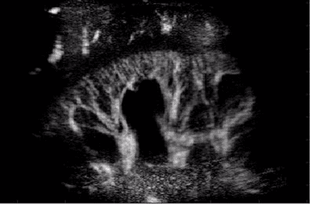 Maestro Universal System - Optoacoustic Tomography And Laser Ultrasound ...