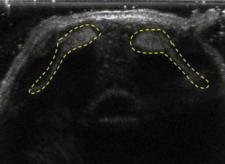 Maestro Universal System - Optoacoustic Tomography And Laser Ultrasound ...