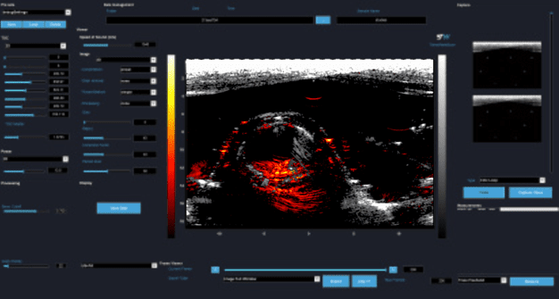 Maestro Universal System - Optoacoustic Tomography And Laser Ultrasound ...