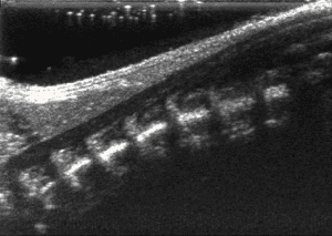 Maestro Universal System - Optoacoustic Tomography And Laser Ultrasound ...