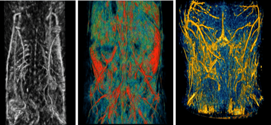 Blog - Optoacoustic Tomography And Laser Ultrasound Systems