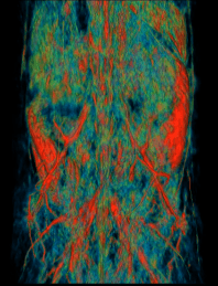 Lois-3D - Optoacoustic Tomography And Laser Ultrasound Systems
